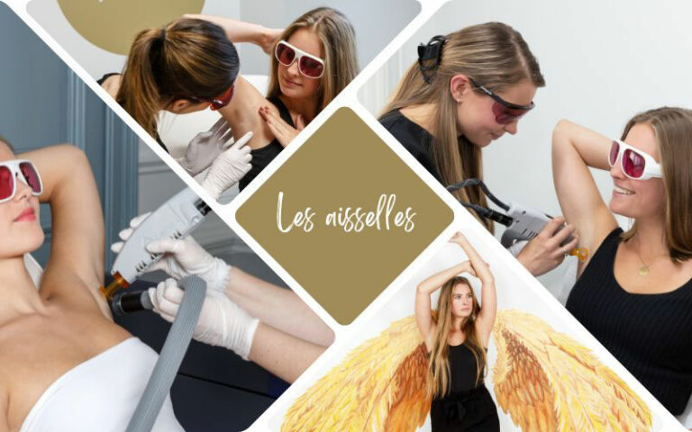 L’épilation laser des aisselles L’épilation laser des aisselles
